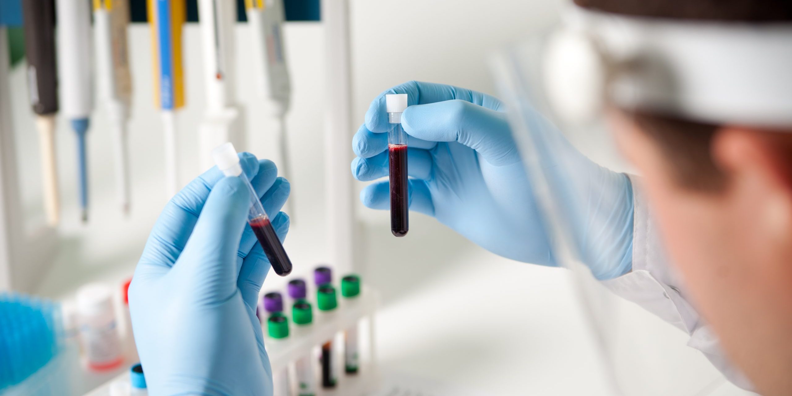 Superior safety profile for decitabine vs chemotherapy for older ...