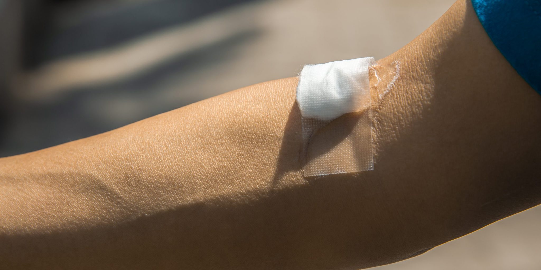 MCED blood test – a gamechanger for early cancer detection